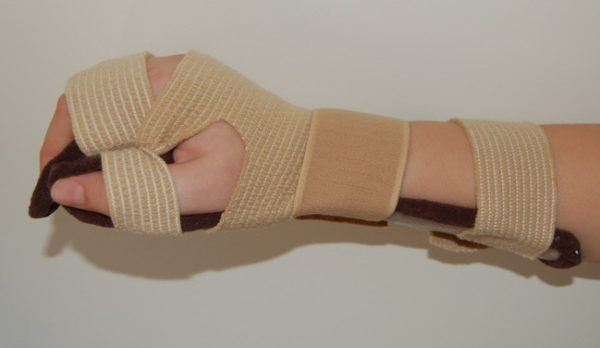 Fabric Lined Splint – PTS