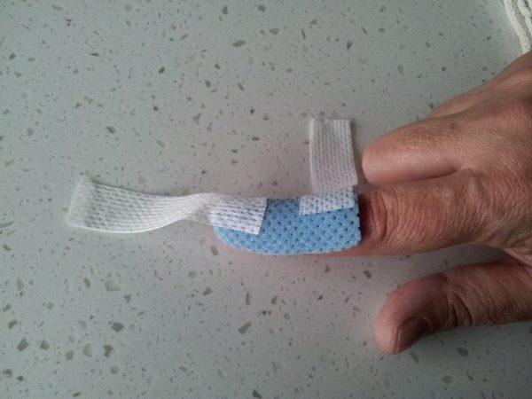 Mallet Splints – PTS