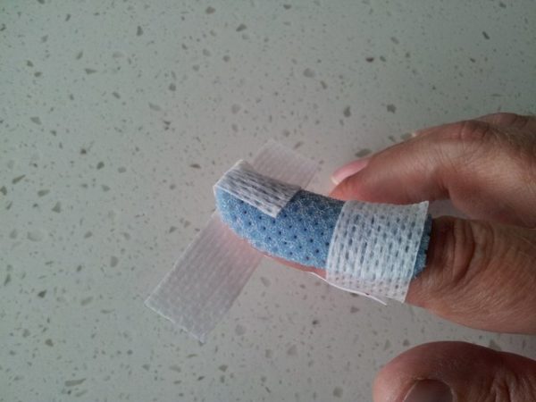 Mallet Splints – PTS